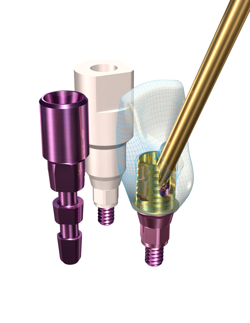 SCD Implant Bundle Southern Cross Dental