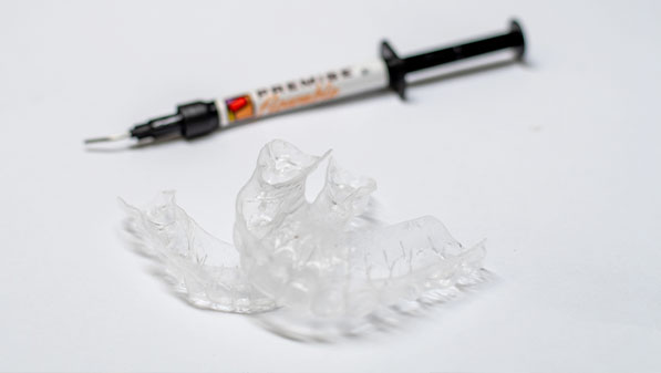 The revolutionary Penn composite Stent™ Southern Cross Dental ...