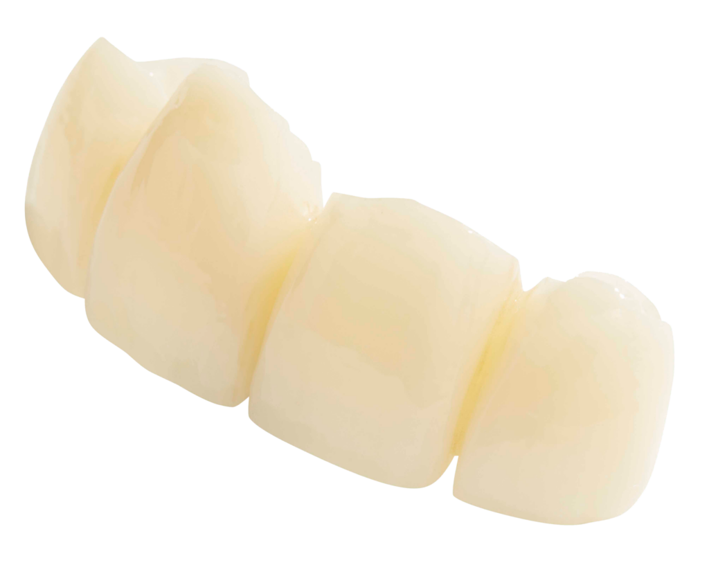 Non metal CERAMAGE | Zirconia crown | Full crown non metallic ...