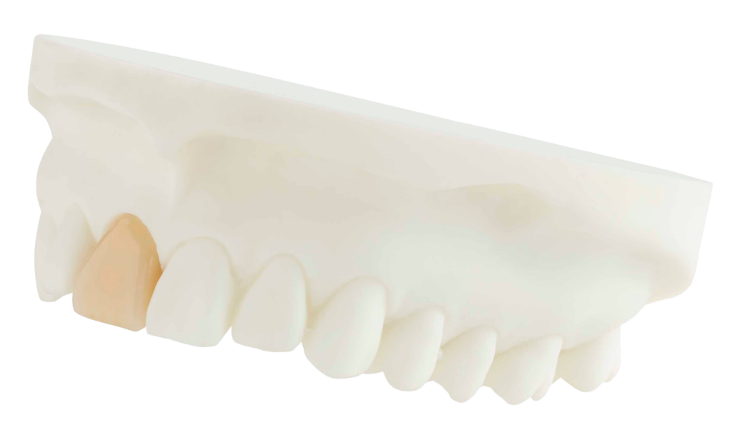 Non metal CERAMAGE | Zirconia crown | Full crown non metallic ...