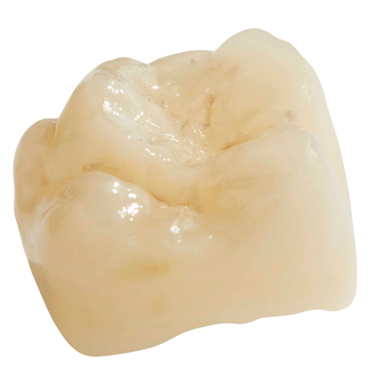 Non-metal CERAMAGE® crowns and bridgework | Southern Cross Dental