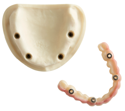 Full Arch Dental Implants Southern Cross Dental