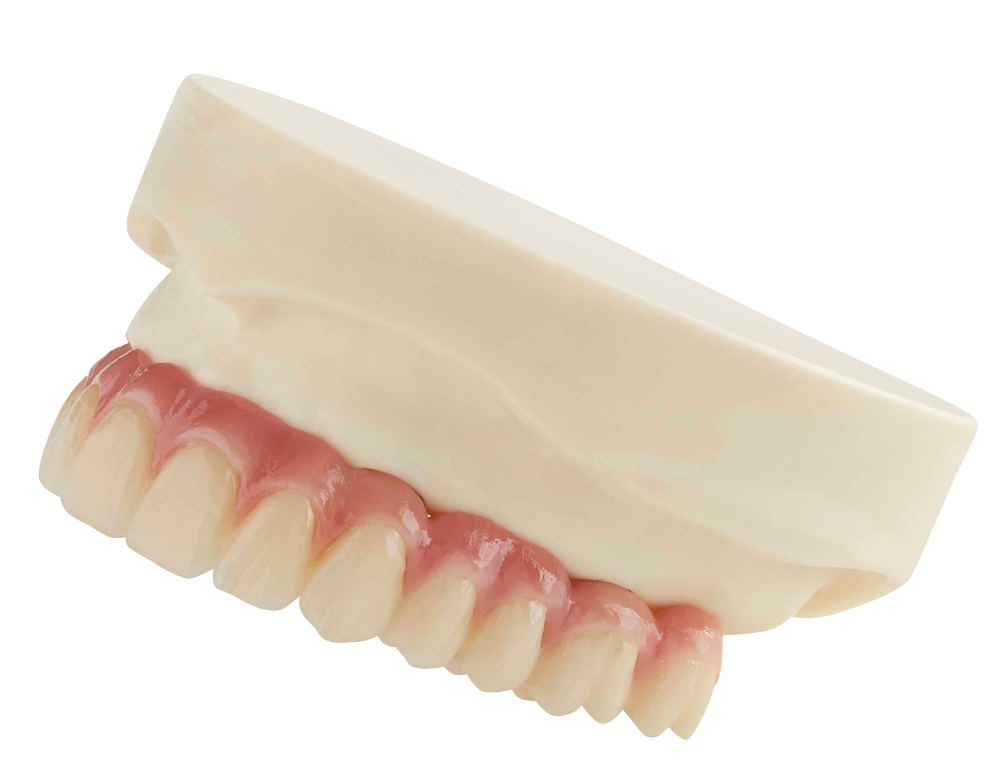 Implant-supported Overdentures | Southern Cross Dental