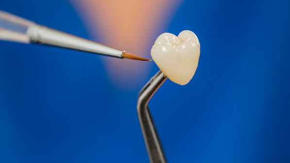 Non-metal CERAMAGE® crowns and bridgework | Southern Cross Dental